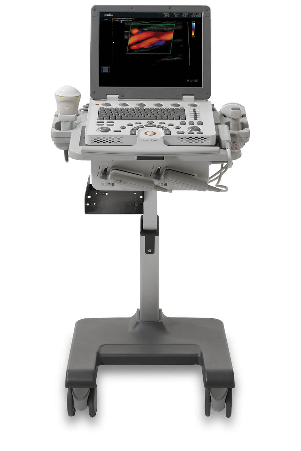 MYSONO U6 EX - Produto | Medisul - Equipamentos Médicos e Assistência ...